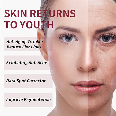 好货Peeling Solution AHA 30% + BHA 2% Exfoliating Facial Ser