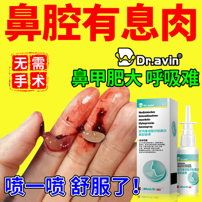 鼻息肉脱落专用特喷雾剂效鼻窦炎鼻甲肥大鼻塞神器药房同售OM