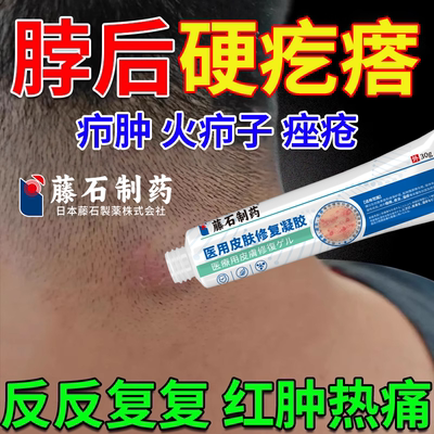 后脖颈长疙瘩泛红脓包药监备案膏