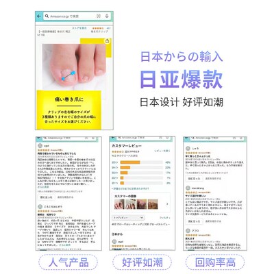 小井甲沟矫正器j嵌甲正甲贴甲片内嵌纠正脚趾甲指矫专用神器炎