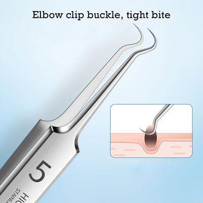 极速German Ultra-fine No. 5 Cell Pimples Blackhead Clip Twee