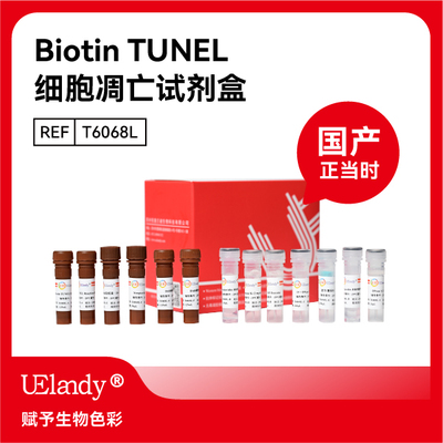 UElandyTUNEL凋亡检测试剂盒