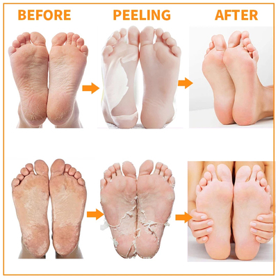 极速Exfoliating Peel Foot Mask Removes Dead SPkin Peeling Of