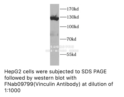 FineTest内参抗体 未标记一抗 VCL-抗体antibody适用ELISA,IHC,WB