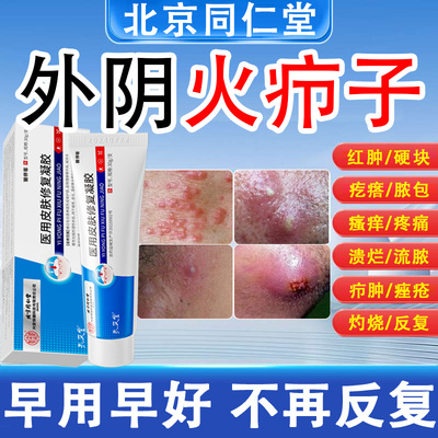 外阴火疖子硬块脓包疖肿拔毒脓皮脂腺囊肿药私处长痘痘敷料膏贴HX