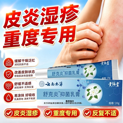 顽固皮炎湿疹瘙痒过敏止痒膏