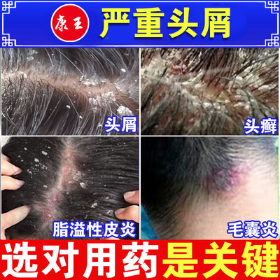 【康王】酮康唑洗剂2%*50ml*1瓶/盒