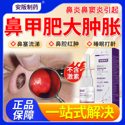 鼻甲肥大肿胀专消炎修复用特鼻炎鼻窦炎效鼻塞堵塞流涕喷雾剂KY