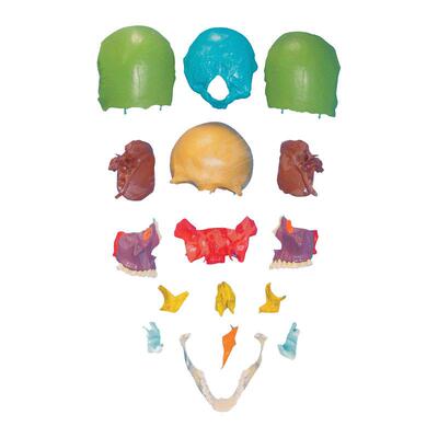 分离头颅骨散骨模型A11117/1