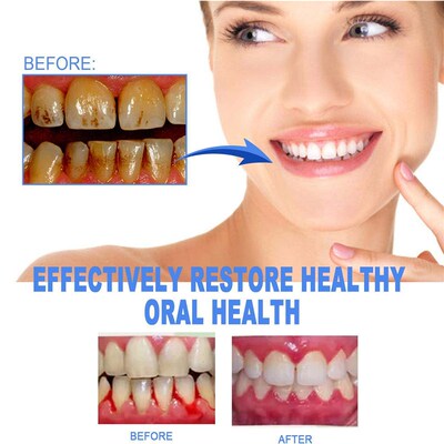 Dental Repair Gel Repair swollen and painful gums Deep clean