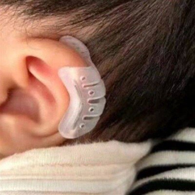 Protruding Ear Support Infant Corrector Tools Silicone
