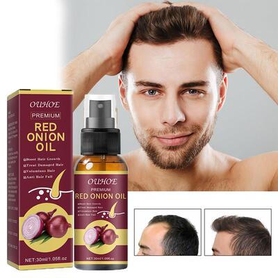 Ginger Hair Growth Essential Oil Fast Grow Anti Hair Loss Pr
