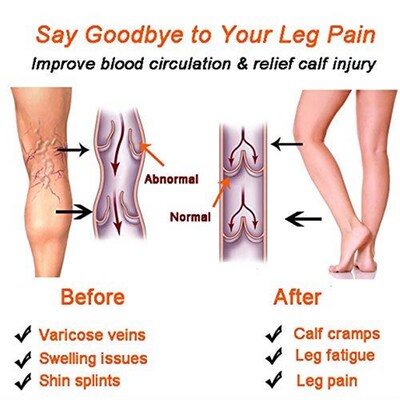 1pair Compression Socks Prevent Calf Varicose Ve Soreness Wo
