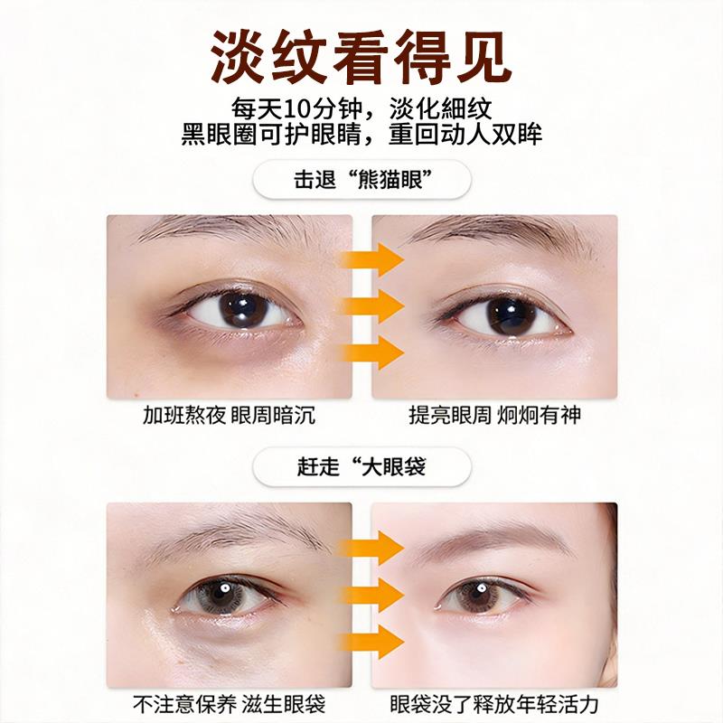眼部按摩仪月牙美眼仪淡化眼袋黑眼圈热敷导入眼霜光疗眼部美容仪