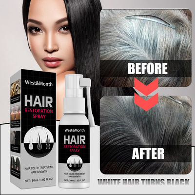 Fast Hair Growth Spray Serum Ginger Anti Hair Loss Treatment