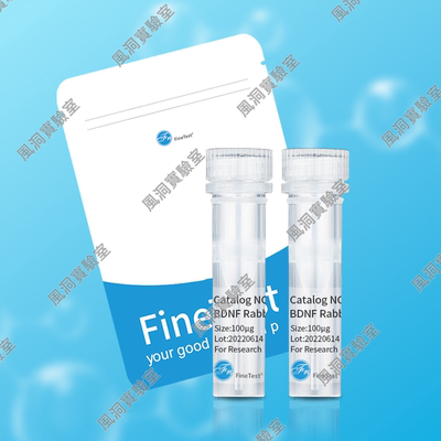 FineTest未标记一抗 Asprosin antibody，Fibrillin-1/FBN1/FBN
