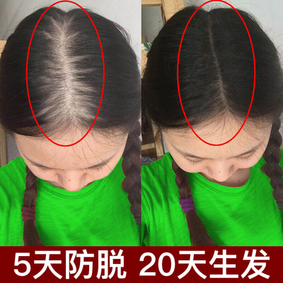 13天包长防脱育发还你发量2发3
