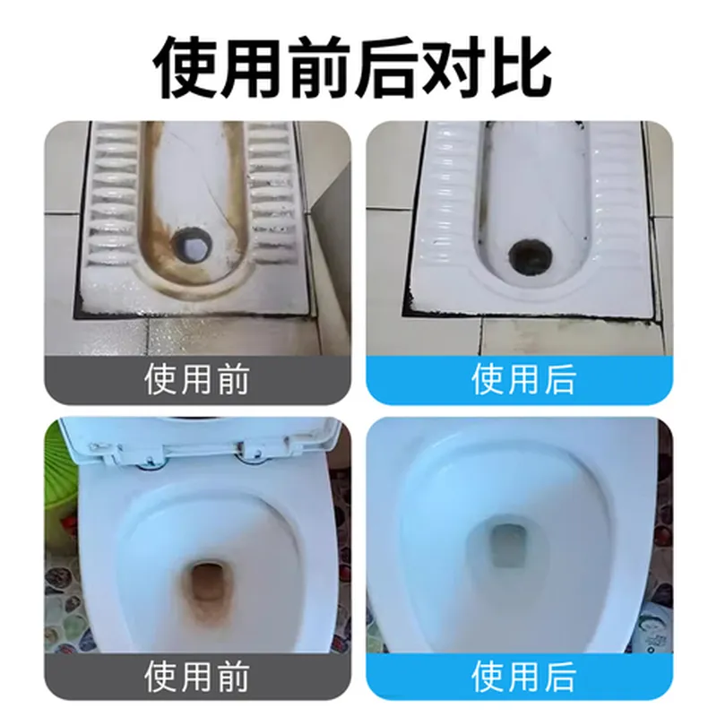 尿碱马桶瓷砖溶解剂清洁剂厕所强力去污去黄草酸小便池尿垢除臭