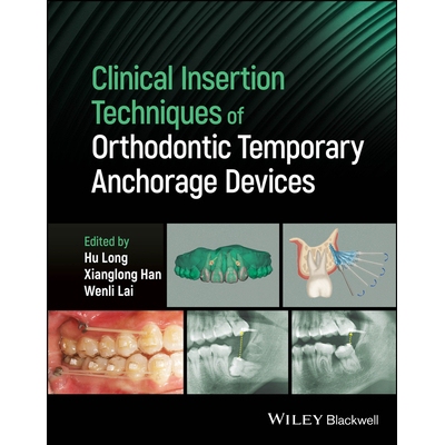 Clinical Insertion Techniques Of Orthodontic Temporary Anchorage Devices 正畸临时支抗装置的临床植入技术 9781119892236