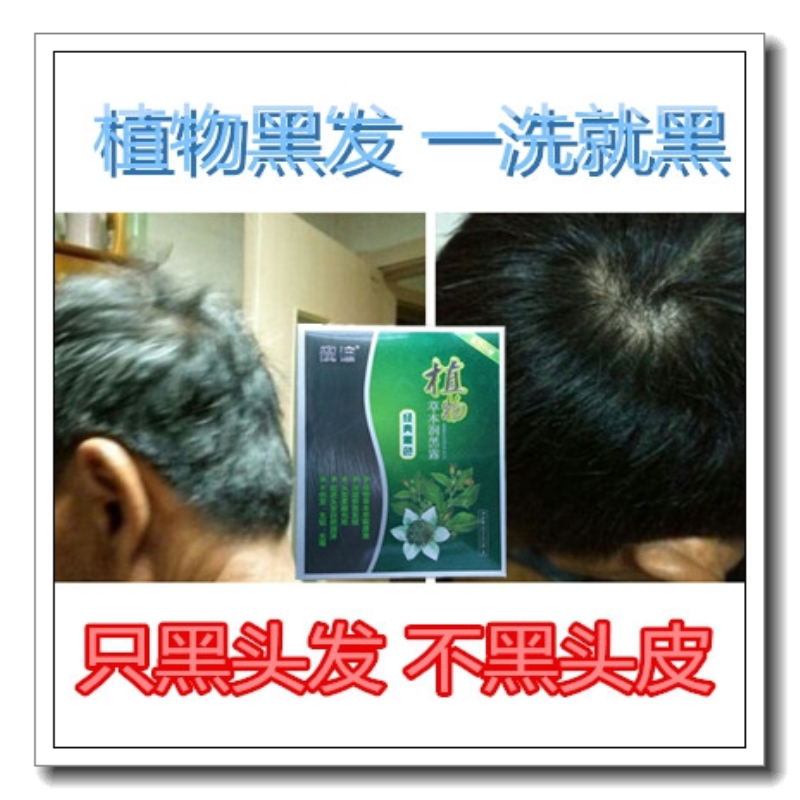 遮盖白发变黑发宝还原乳染头发膏洗发水正品去屑控油止痒植物产品