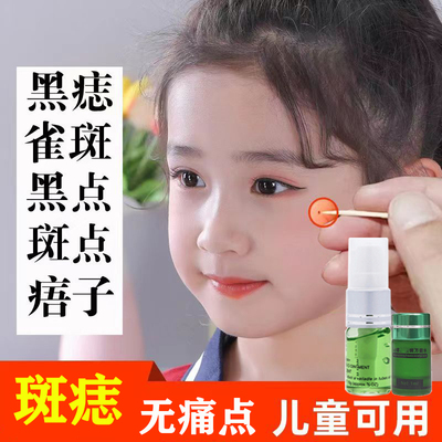 点痣家用去痣无痕去黑点痦子去除