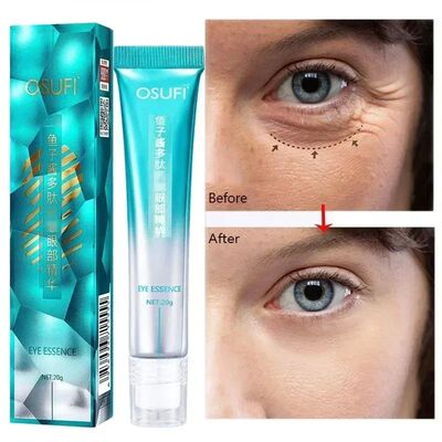 Anti-Wrinkle Dark Circles Eye cream Remove eye bags Puffines