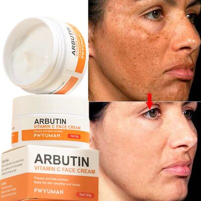 Powerful Whiten Freckle Cream Fast Remove Melasma Melanin Co