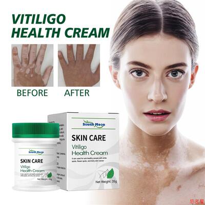 Whitespot care cream to lighten white spots 白斑护理膏 淡化