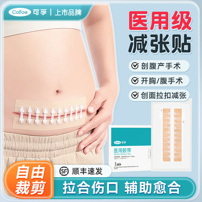 可孚医用减张贴剖腹产甲状腺术后伤口辅助愈合免缝合胶带减张器