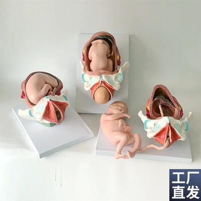 妊娠分娩过程助产示教产程胎位产道产G科妇幼教学胎儿分娩演示促