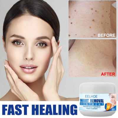 EELHOE Wart Removal Cream 皮肤去尤膏清洁克尤身体护理膏50g