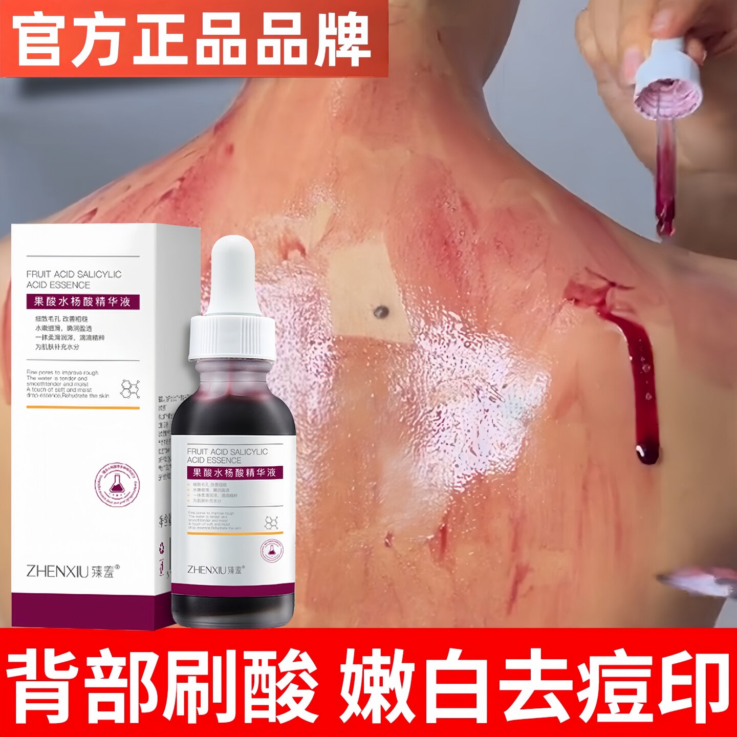 背部刷酸嫩白后背水杨酸果酸精华亮肤美身体全身刷酸去鸡皮肤白