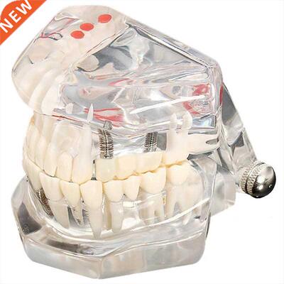Tooth model model dental care model denture dentist Dental D