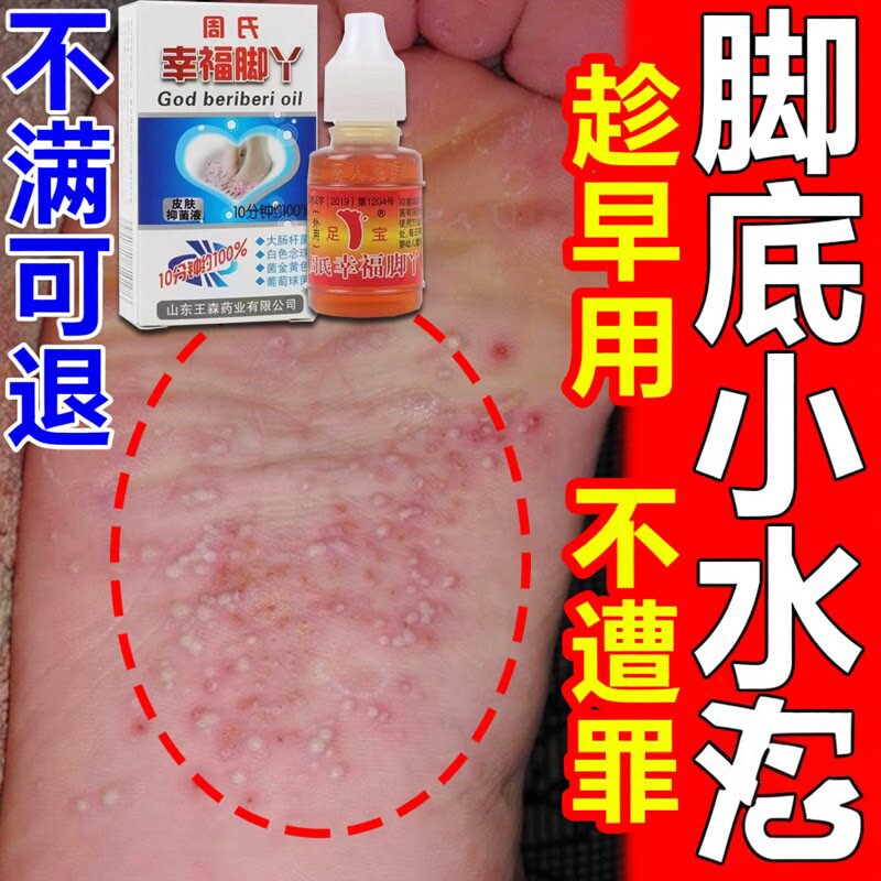 老牌子幸福脚丫脚气脚臭脚痒糜烂小水泡真菌感染止痒草本外用液