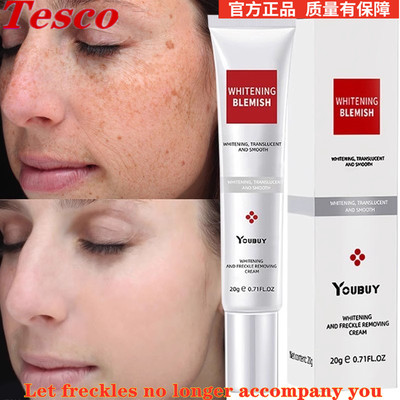 whitengfrecklamovspbFS