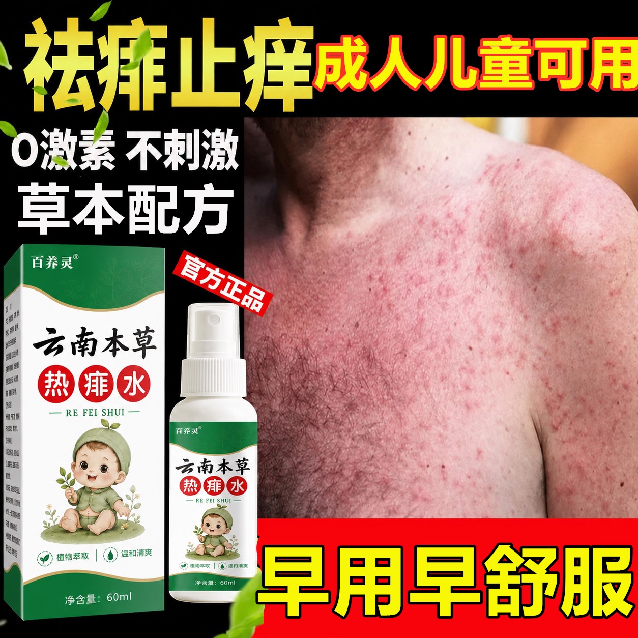 成人儿童去热痱子喷雾去热疙瘩热疹祛痱止痒热痱水爽身痱子粉喷雾