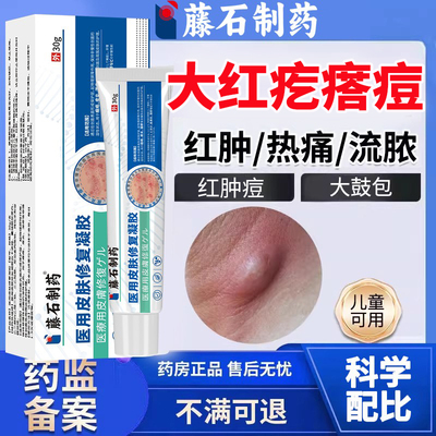 硬疙瘩/红肿/脓包痤疮