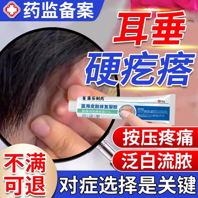【耳垂硬疙瘩】耳垂长痘疼痛专用