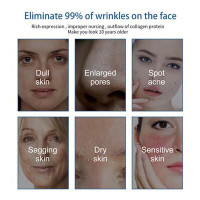 Deep moist surface cream.