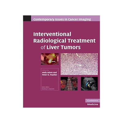 【预售】Interventional Radiological Treatment of Liver