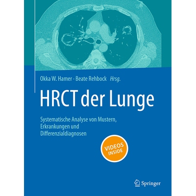 预订 HRCT der Lunge Systematische Analyse von Mustern, Erkrankungen und Differentialdiagnosen 9783662647639