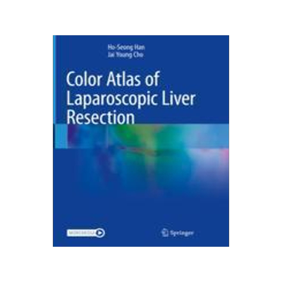 [预订]Color Atlas of Laparoscopic Liver Resection 9789811615450
