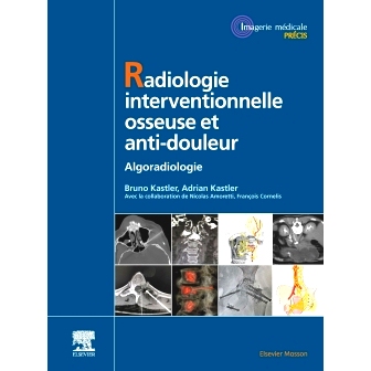 预订 Radiologie interventionnelle osseuse et anti-douleur 介入骨与疼痛放射学: 9782294766312