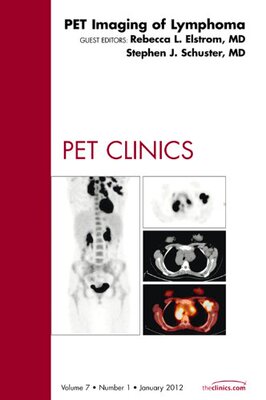 【预订】PET Imaging of Lymphoma, An Issue of PET Clinics