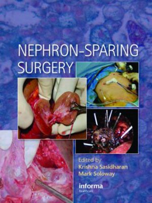 【预订】Nephron-Sparing Surgery