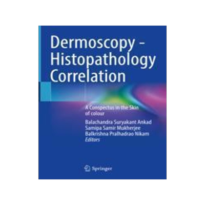 [预订]Dermoscopy - Histopathology Correlation 9789813346376