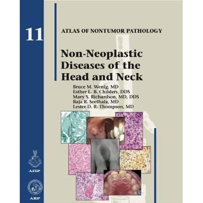 预订 Non-Neoplastic Diseases of the Head and Neck 头颈部非发育性疾病（丛书）: 9781933477374