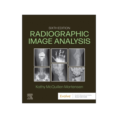 预订 Radiographic Image Analysis
