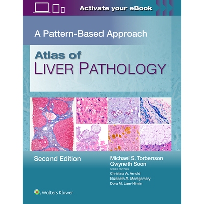 预订 Atlas of Liver Pathology A Pattern-Based Approach 肝脏病理学图解 9781975240110