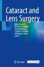 【预订】Cataract and Lens Surgery 9783031053931